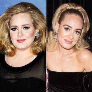 Celebrity Scope: ADELE SURGERY! | Blog | Clinic Center